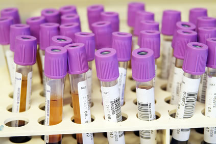 Service Charter - Di Piazza Medical Laboratory – Palermo